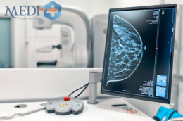 Chụp cộng hưởng từ (MRI) là gì? Khi nào nên chụp cộng hưởng từ?